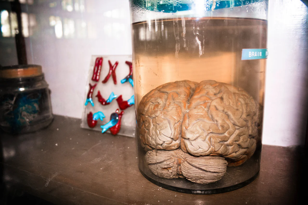 The brain bank needs more brains | The Outline
